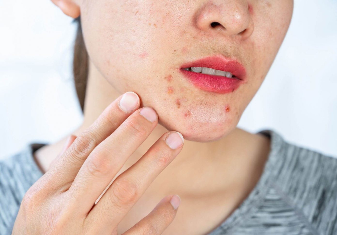Red small spots on skin: Causes and Treatment - Recibeauty